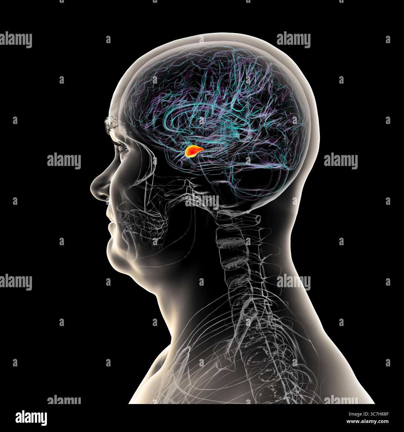 Illustration of a human brain with highlighted amygdala. This is ...