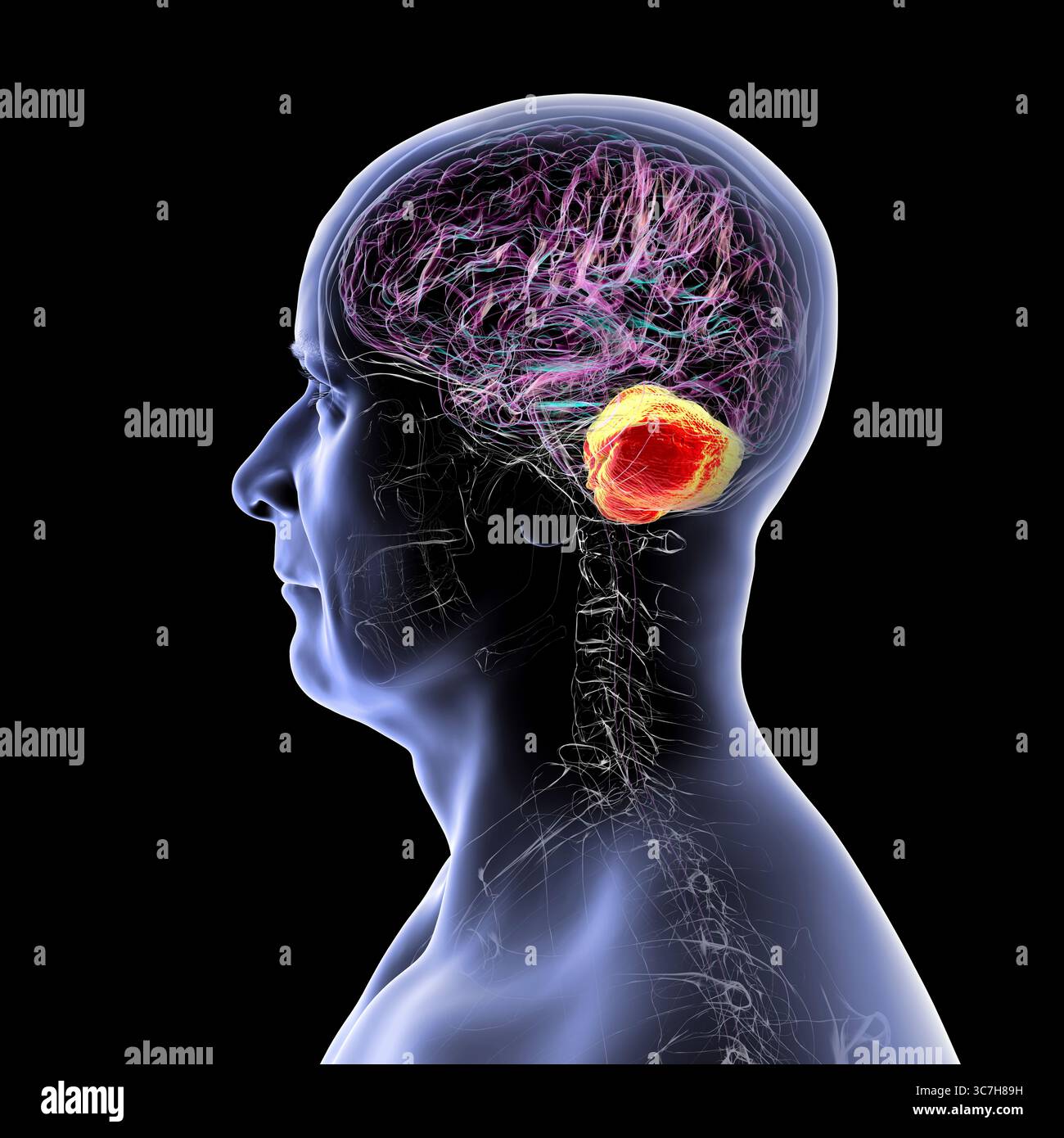 Illustration of the human brain with highlighted cerebellum. This is ...