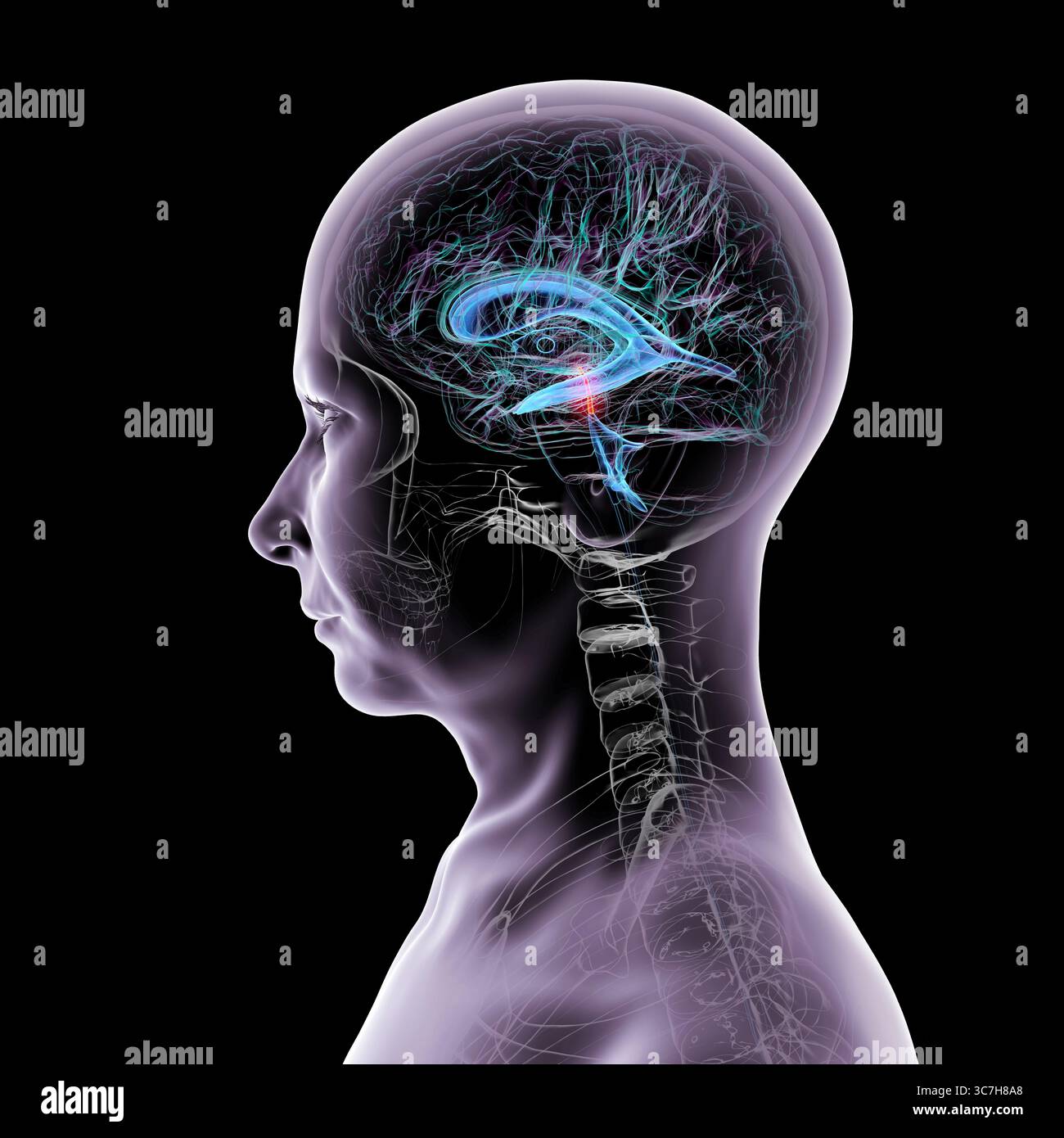 Illustration of the brain with the cerebral aqueduct highlighted (red ...