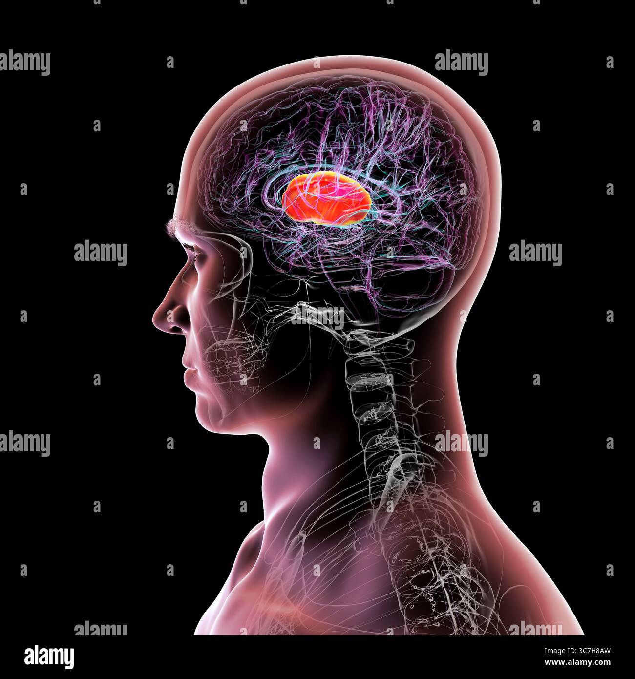 Loss of motor function hi-res stock photography and images - Alamy