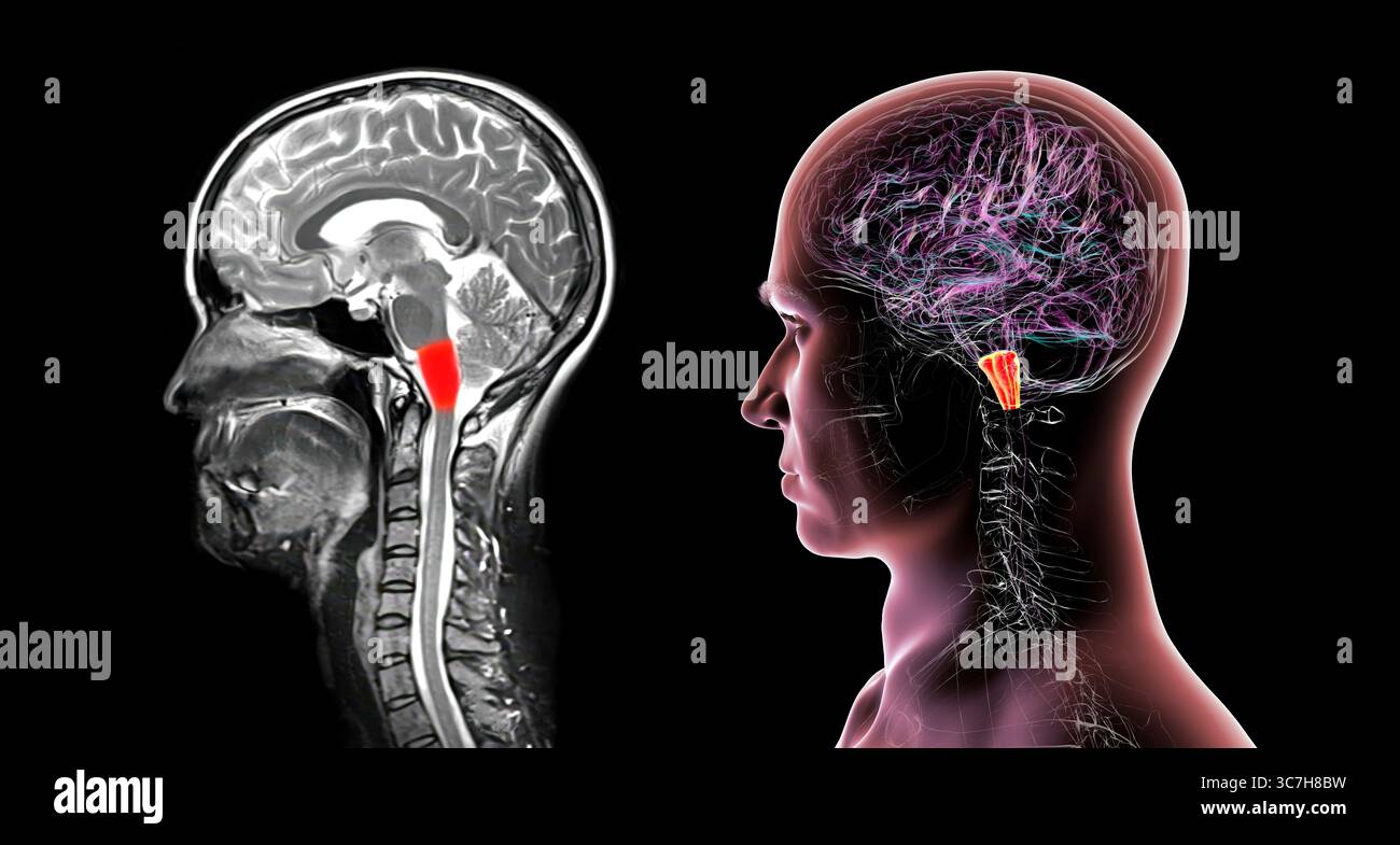Human nervous system imaging hi-res stock photography and images - Alamy