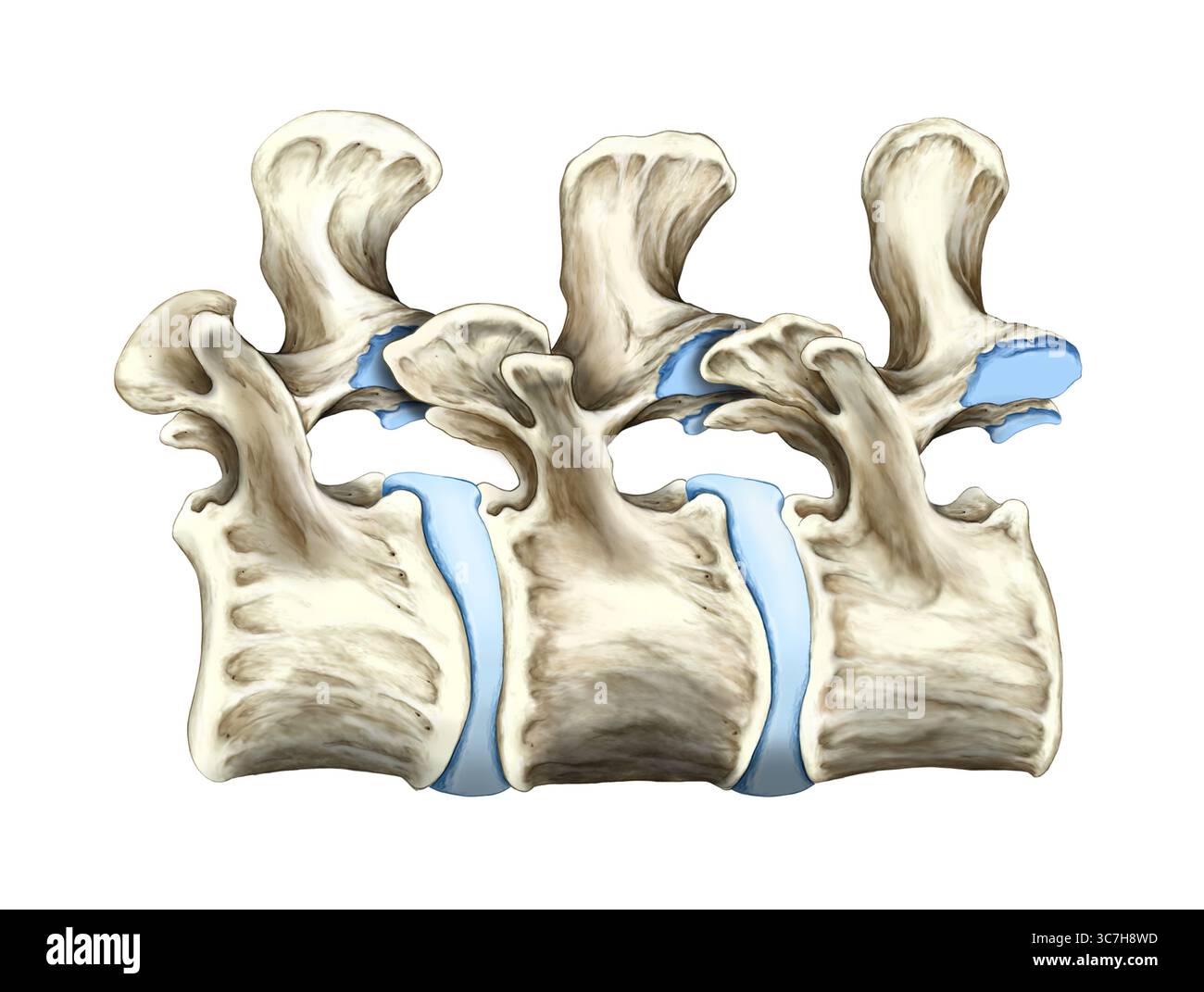 Illustration showing multiple lumbar vertebrae in a lateral view. The ...