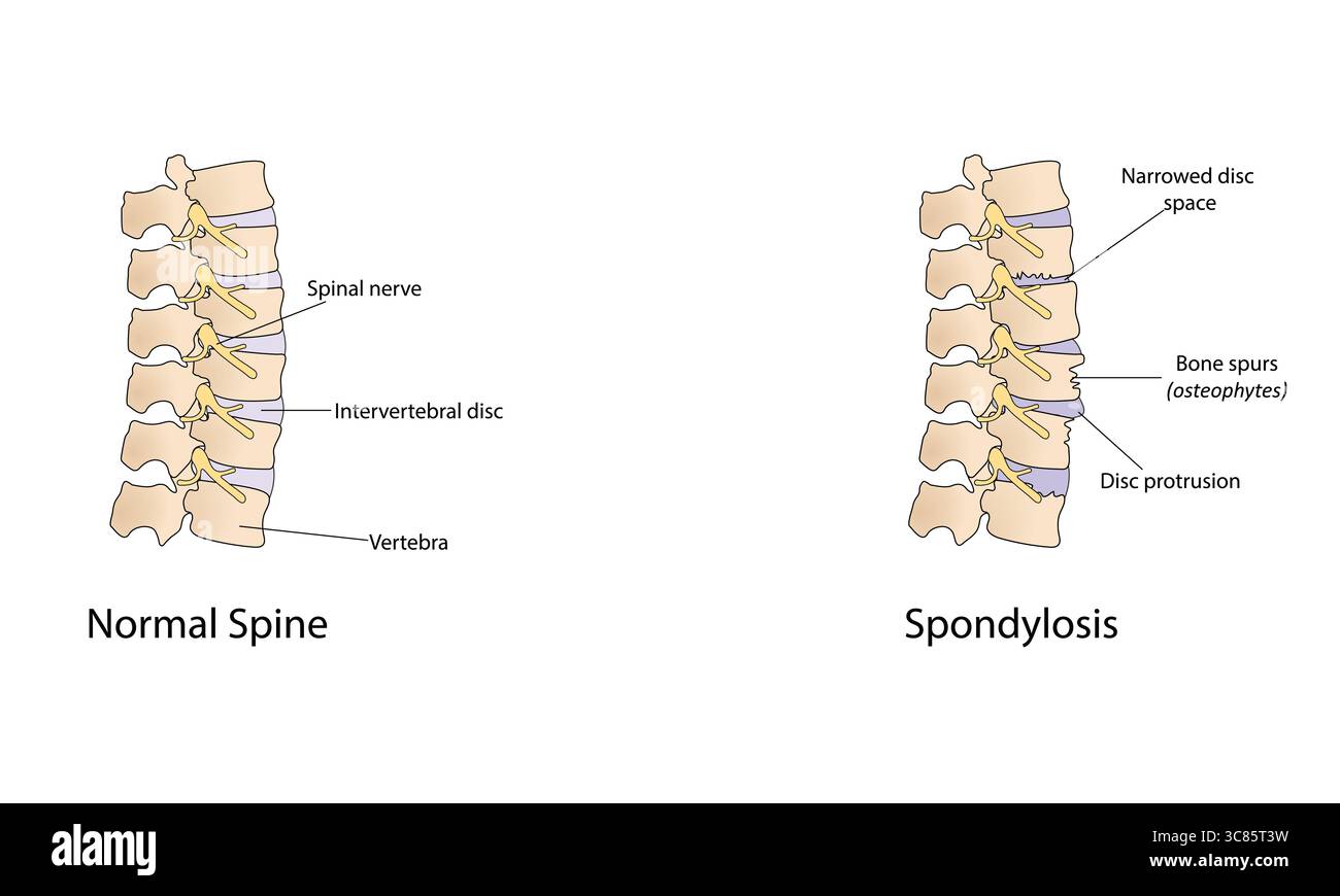 Illustration lumbar vertebrae spinal Stock Vector Images - Alamy