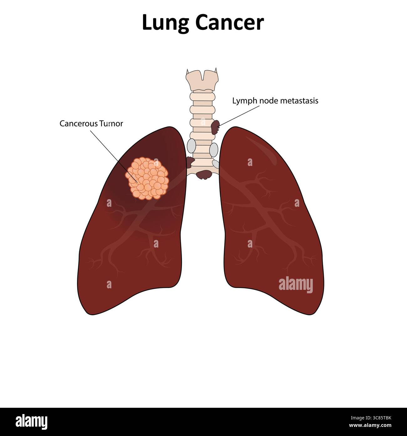 Illustration structure pulmonary alveoli hi-res stock photography and images - Alamy