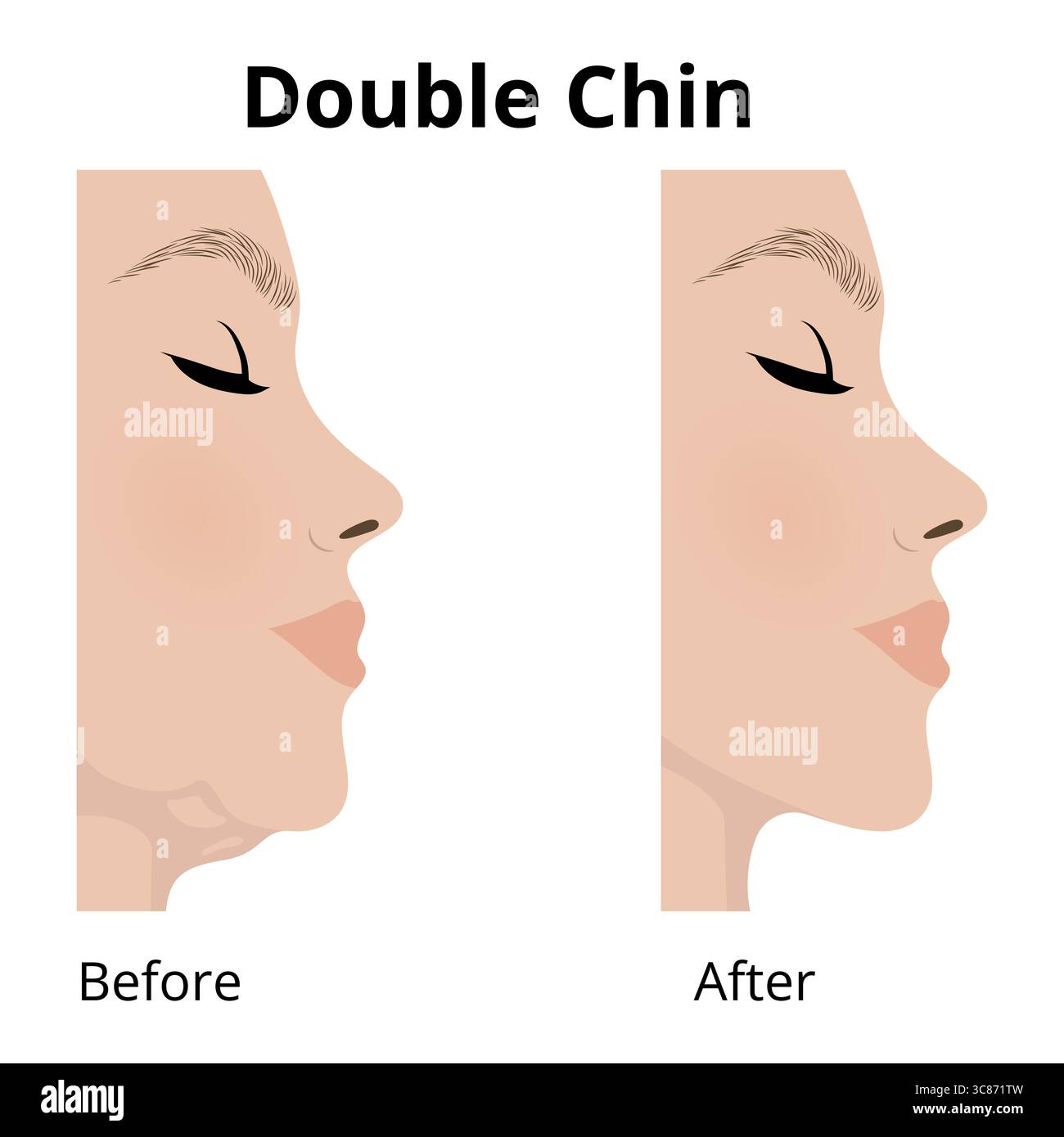 Comparison results before after Cut Out Stock Images & Pictures - Alamy