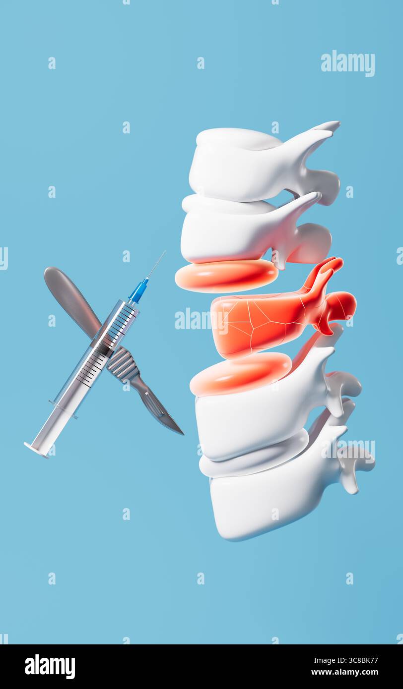 Human spine and surgical tools, 3d rendering. 3d illustration Stock ...