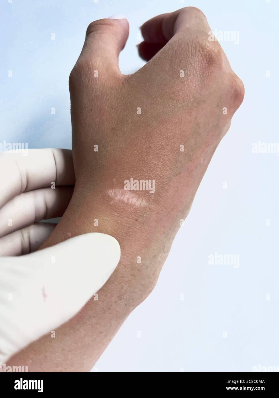 Post op monitoring hi-res stock photography and images - Alamy