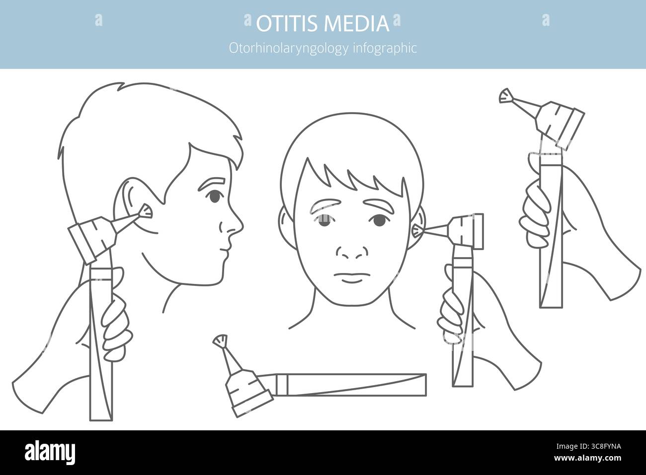 Otitis media. Infection in the middle ear. Otological disorders ...