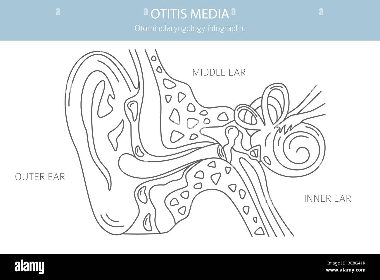 Otitis media. Infection in the middle ear. Otological disorders ...