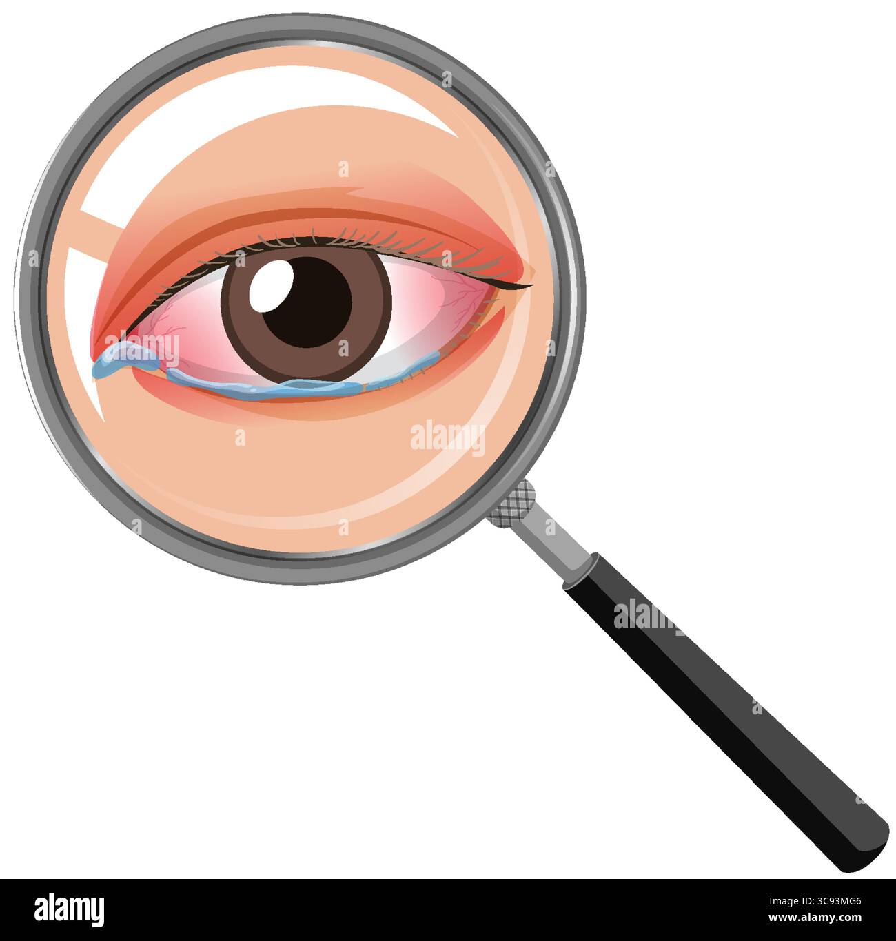 Vector illustration of a human eye viewed through a magnifying glass ...