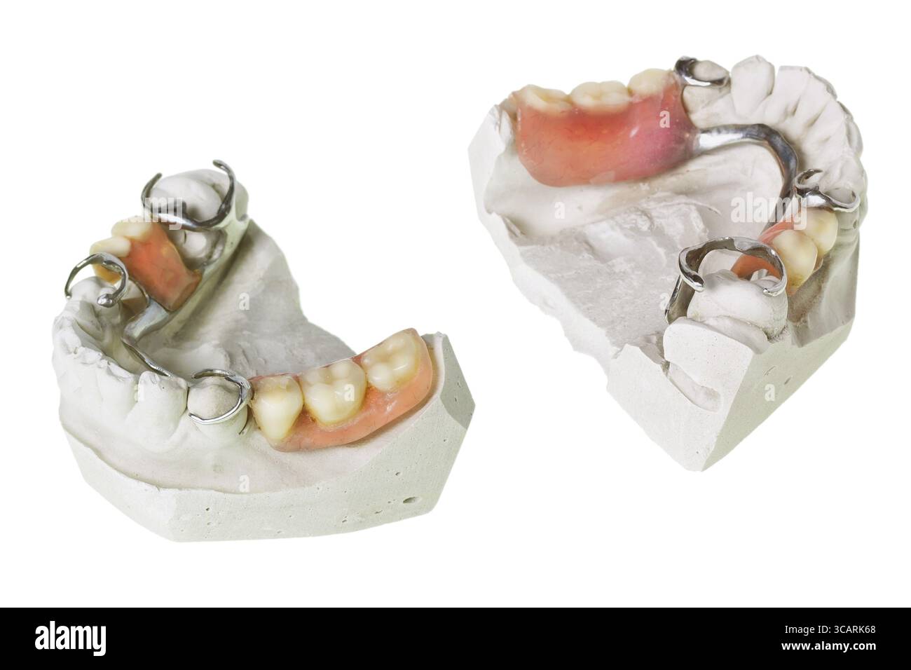 Plaster cast of teeth and dentures, which is made in this mold isolated ...