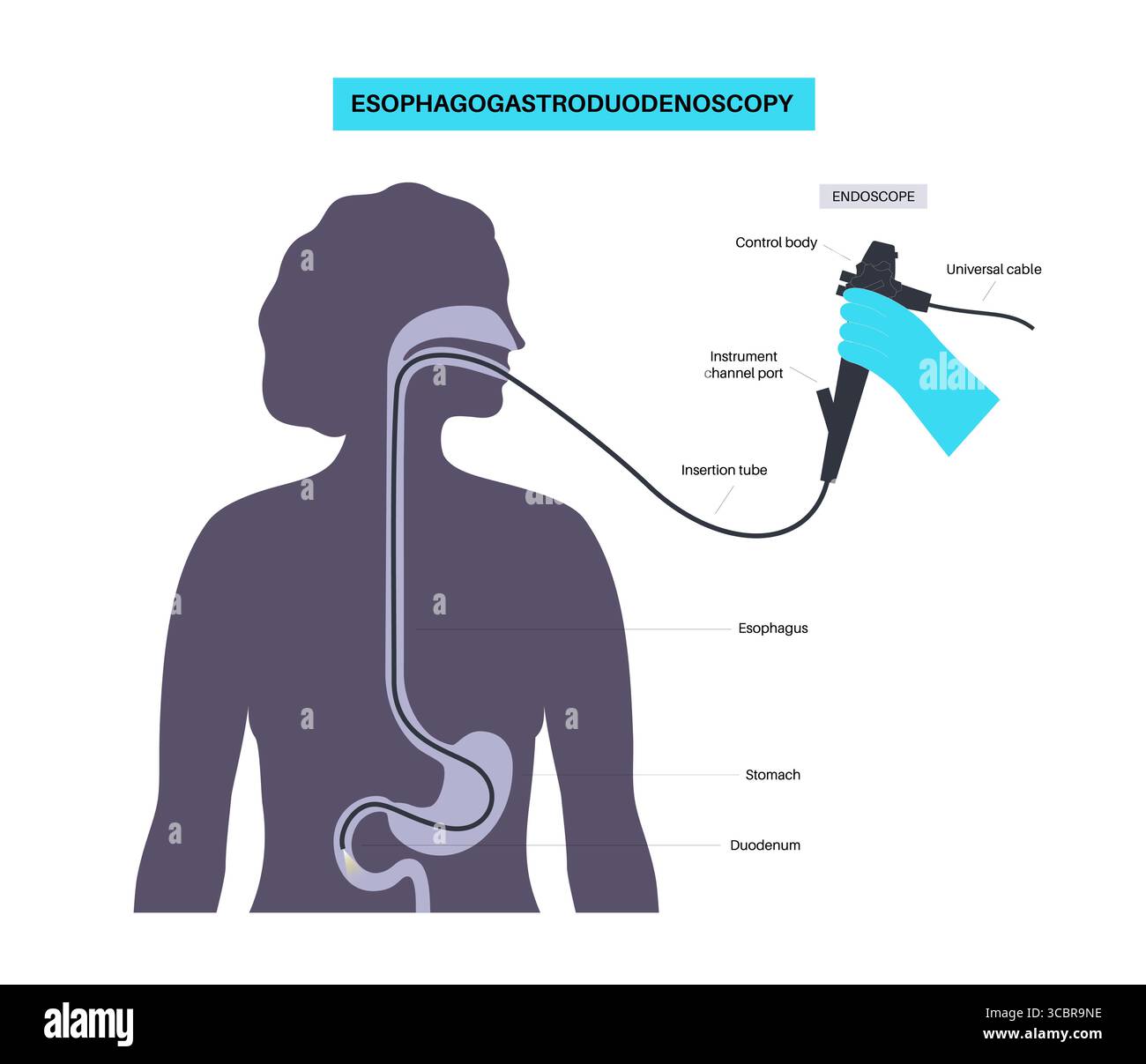 Inserted in the diagram hi-res stock photography and images - Alamy