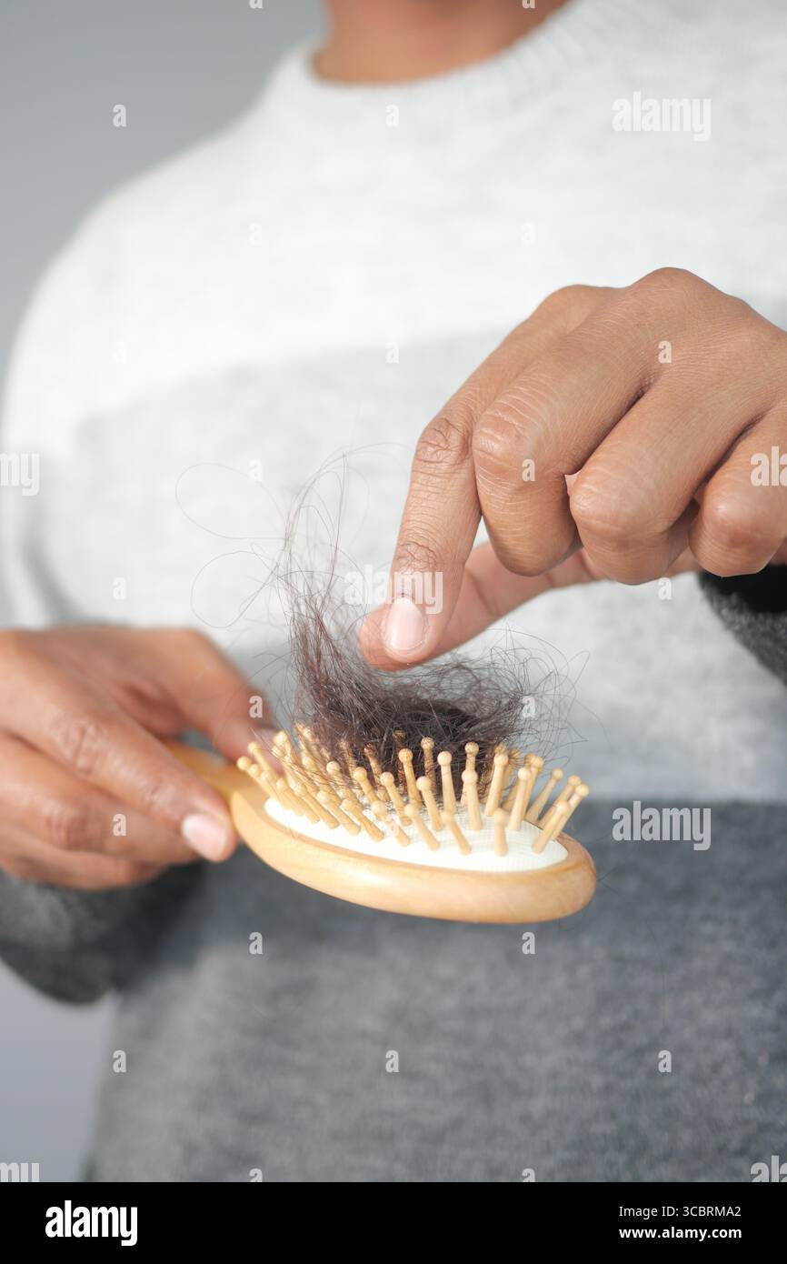 Hair loss while brushing indicates potential health issues Stock Photo ...