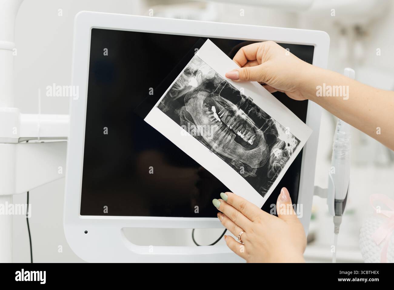 the dentist holds in his hands an X-ray examination of the oral cavity ...