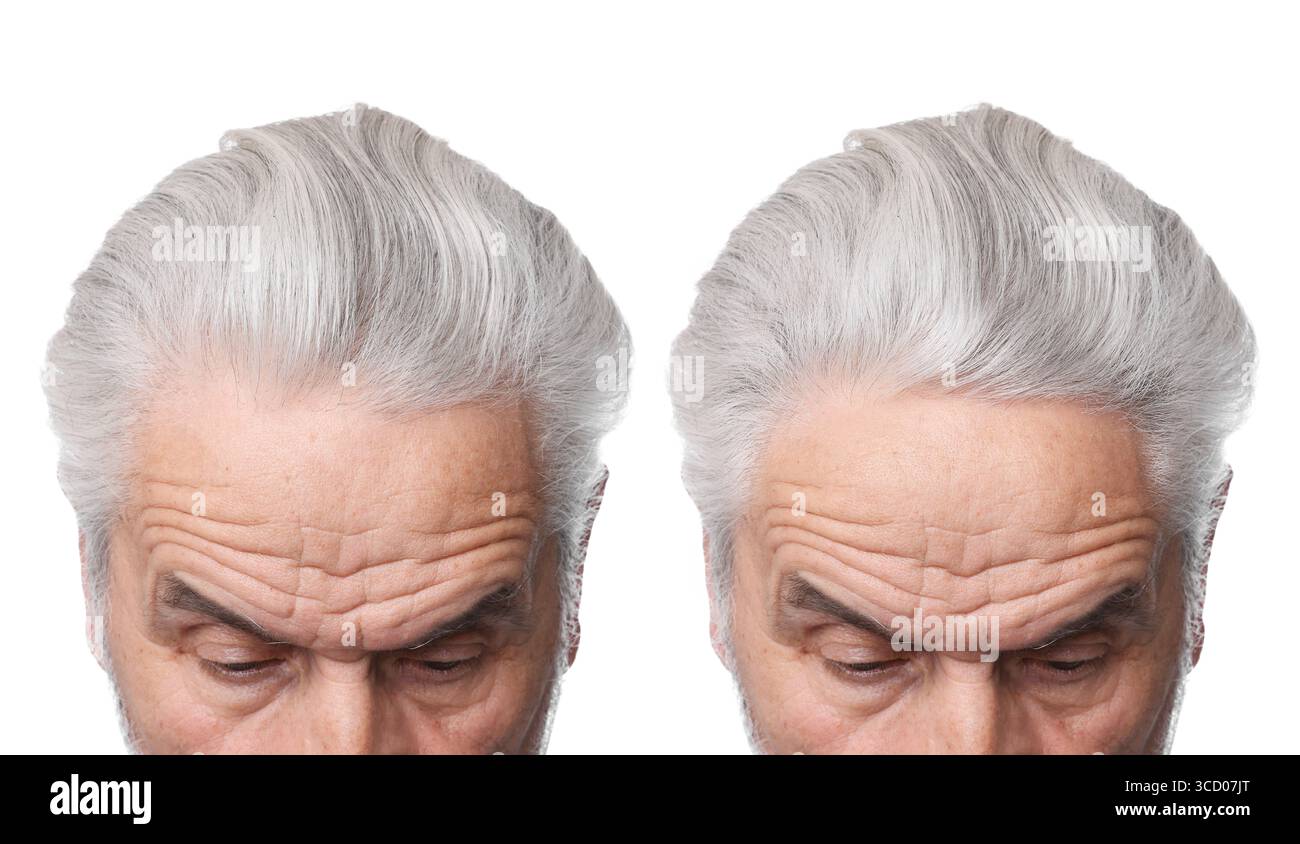 Old man before after Cut Out Stock Images & Pictures - Alamy