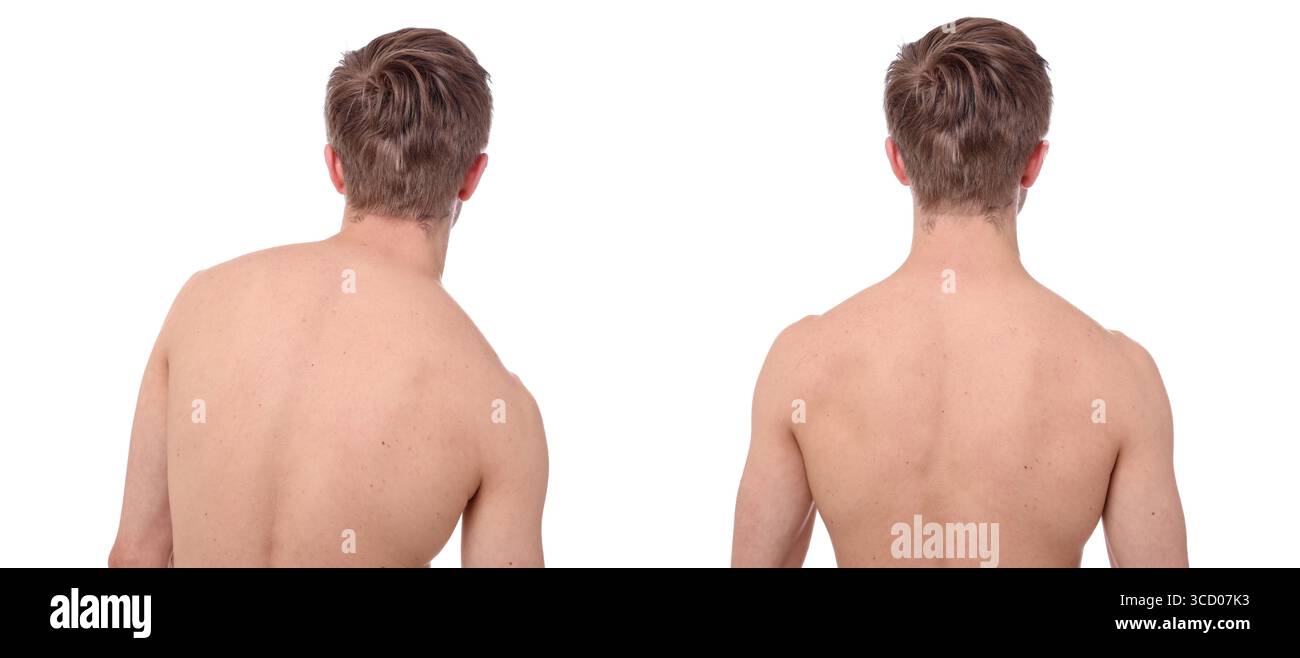 Before and after collage showing man with good and bad posture against ...