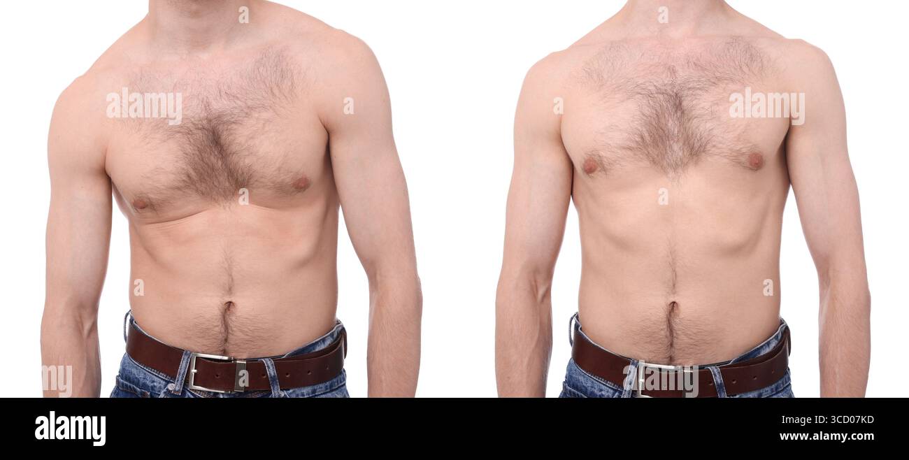 Before and after collage showing man with good and bad posture against ...