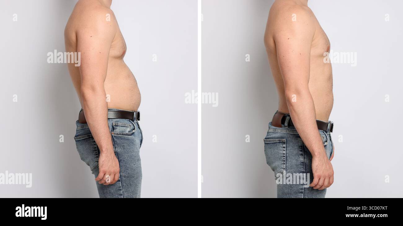 Before and after collage showing man with good and bad posture against ...