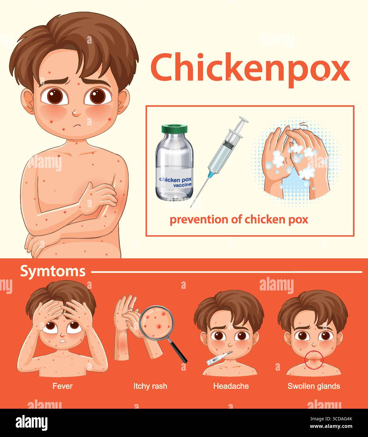 Educational vector illustration showing a child with chickenpox, common ...