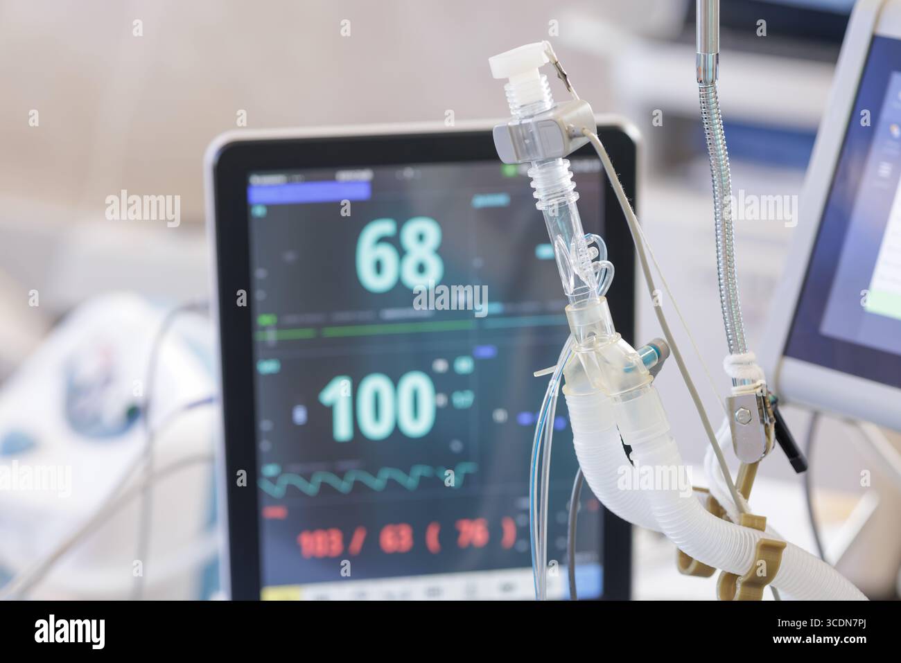 Ventilator breathing circuit and patient vital signs monitor in a ...