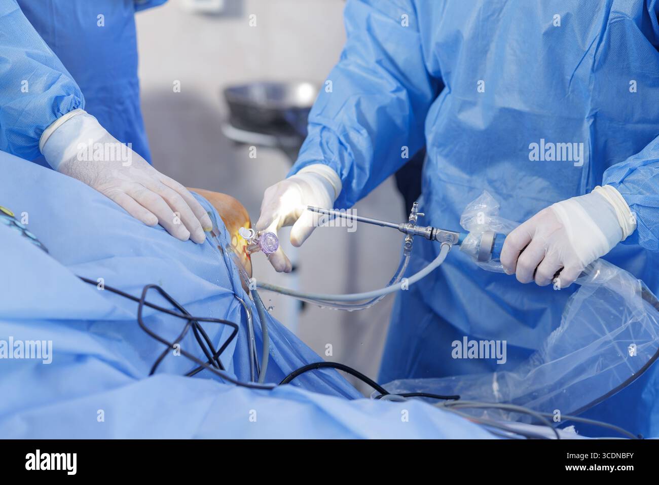 Surgeons perform knee arthroscopy with PCL reconstruction using ...