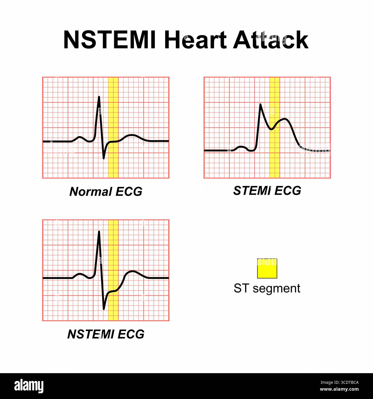 Attack wave Cut Out Stock Images & Pictures - Alamy