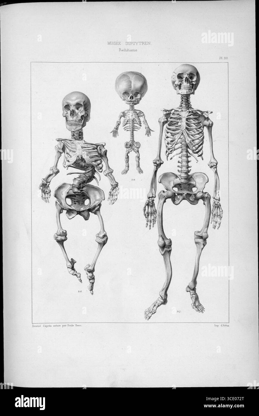 Planche 20 Black and White Stock Photos & Images - Alamy