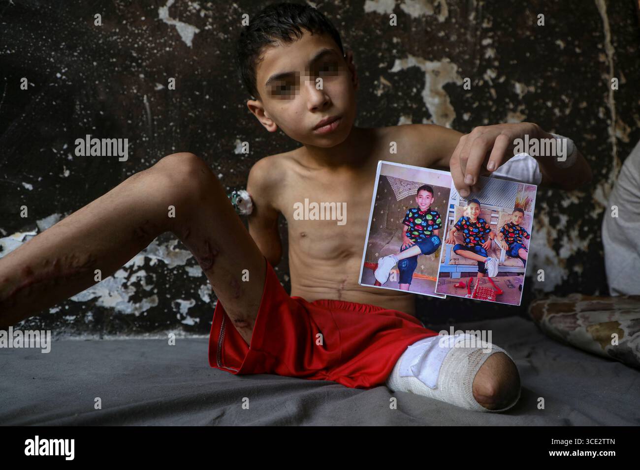 (250815) -- GAZA, Aug. 15, 2025 (Xinhua) -- Palestinian child Samir ...