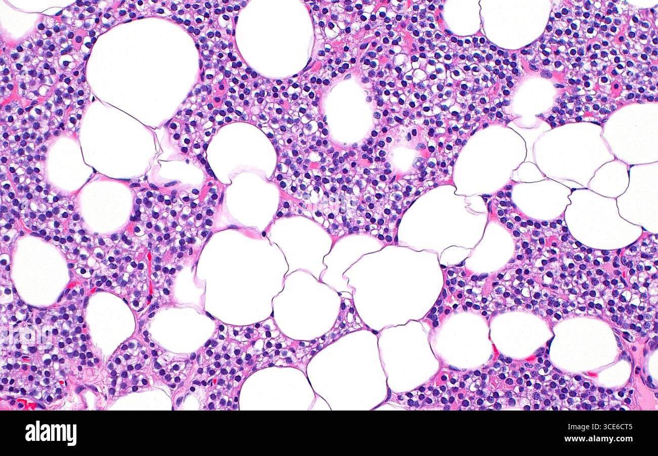 Light micrograph of parathyroid gland cells. The parathyroid gland ...