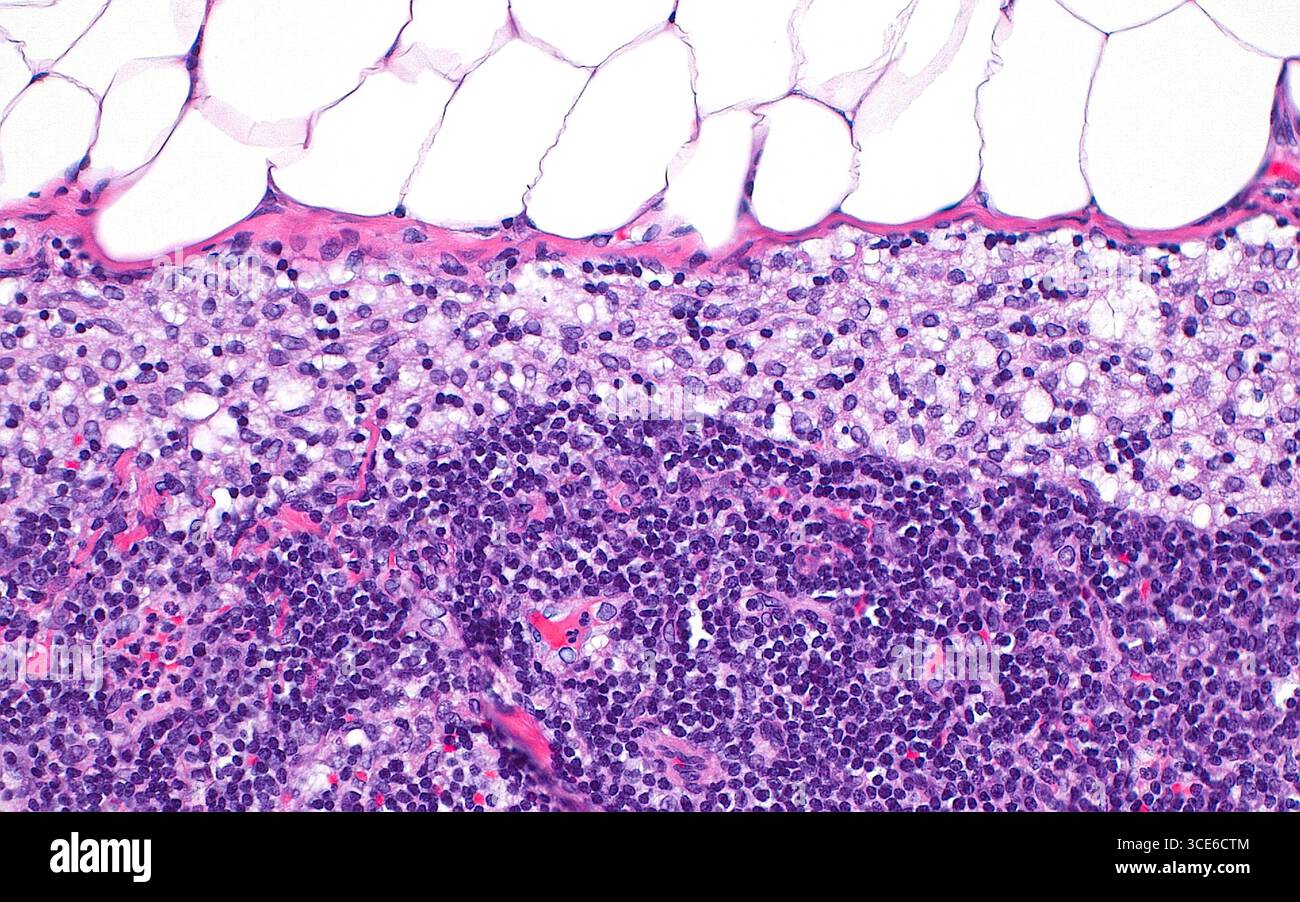 Macrophages in lymphoid tissue hi-res stock photography and images - Alamy