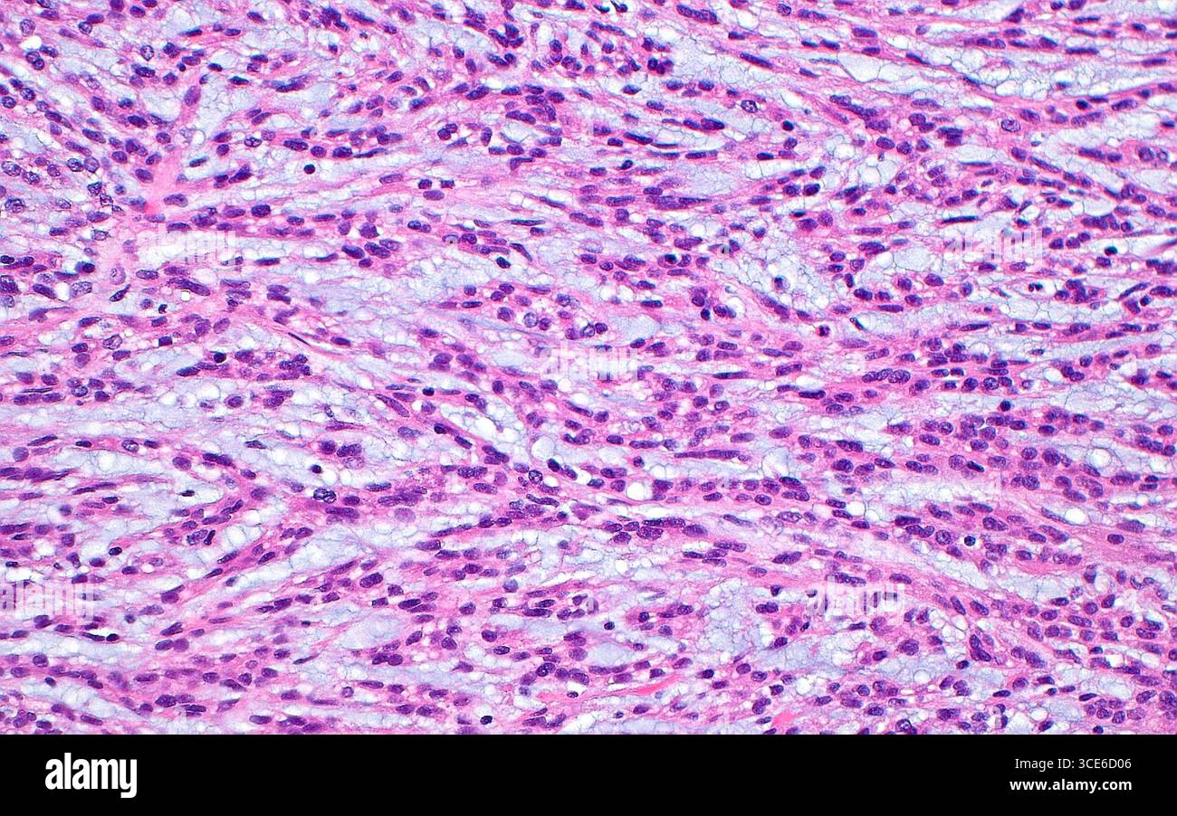 Tubular kidney cells hi-res stock photography and images - Alamy