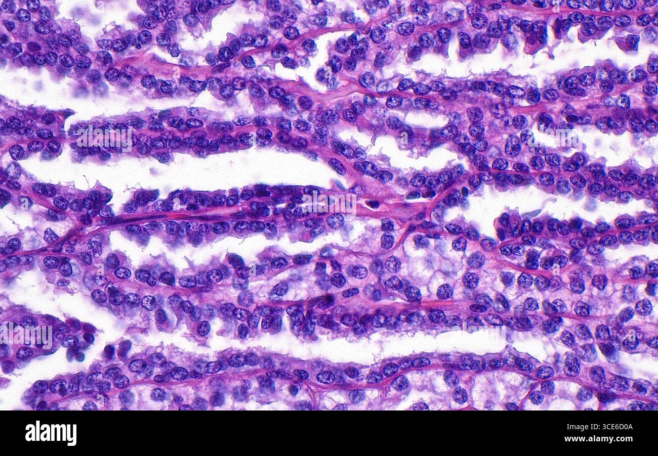 Elongated cell patterns hi-res stock photography and images - Alamy