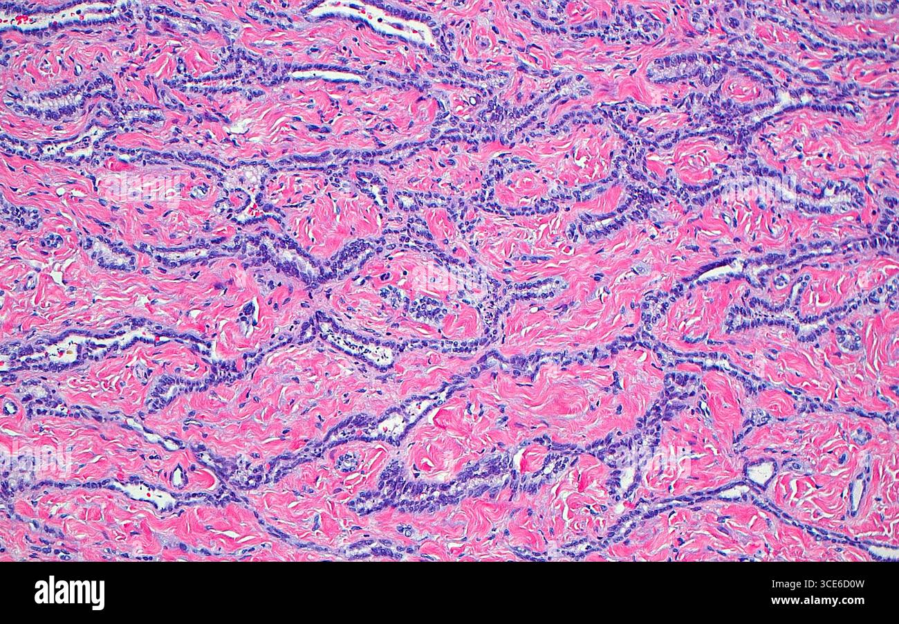 Male genital system hi-res stock photography and images - Alamy