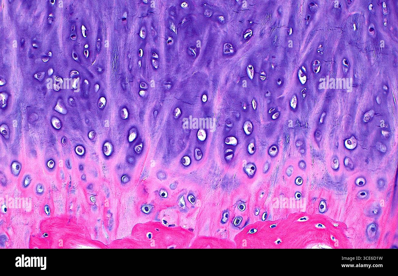 Light micrograph of articular cartilage, which is the cartilage ...