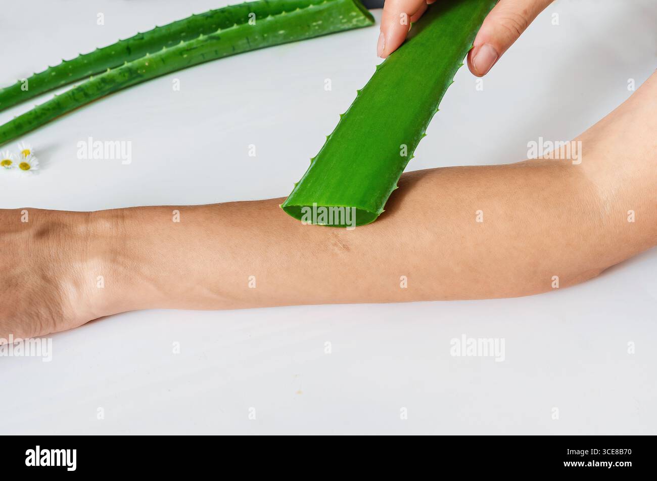 Scar treatment with aloe vera. Woman applying aloe vera to remove scar ...