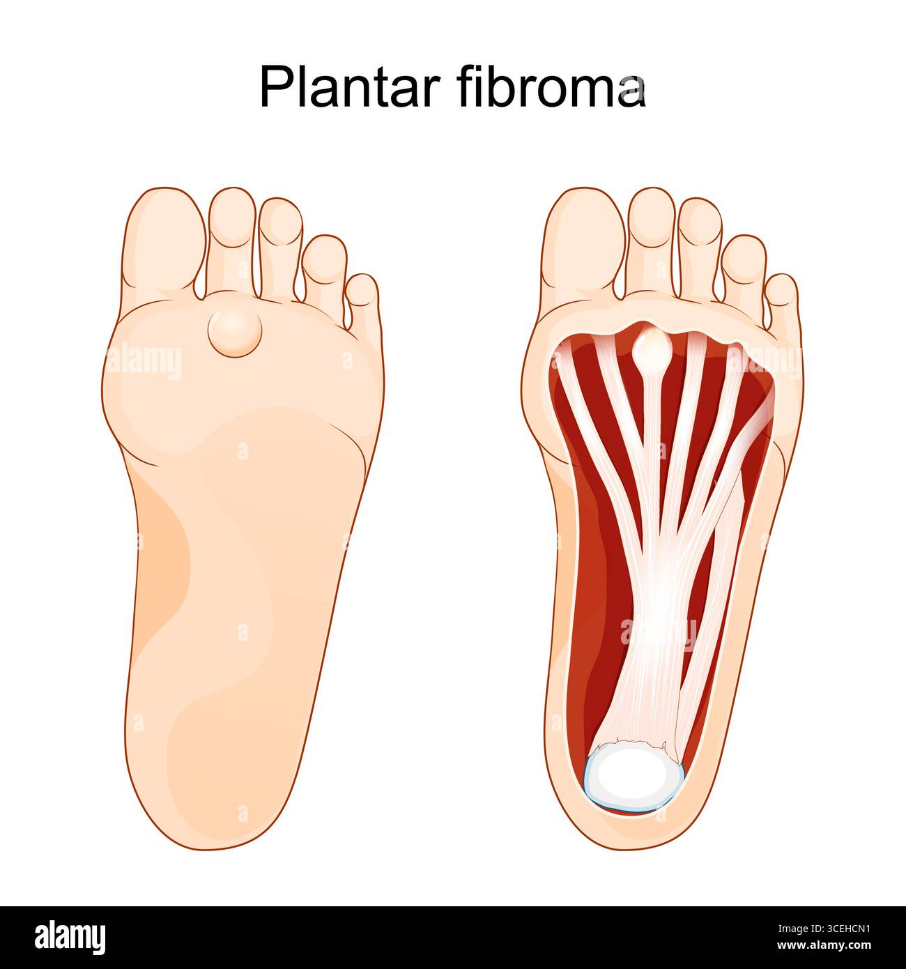 Of fascial nerve Cut Out Stock Images & Pictures - Alamy