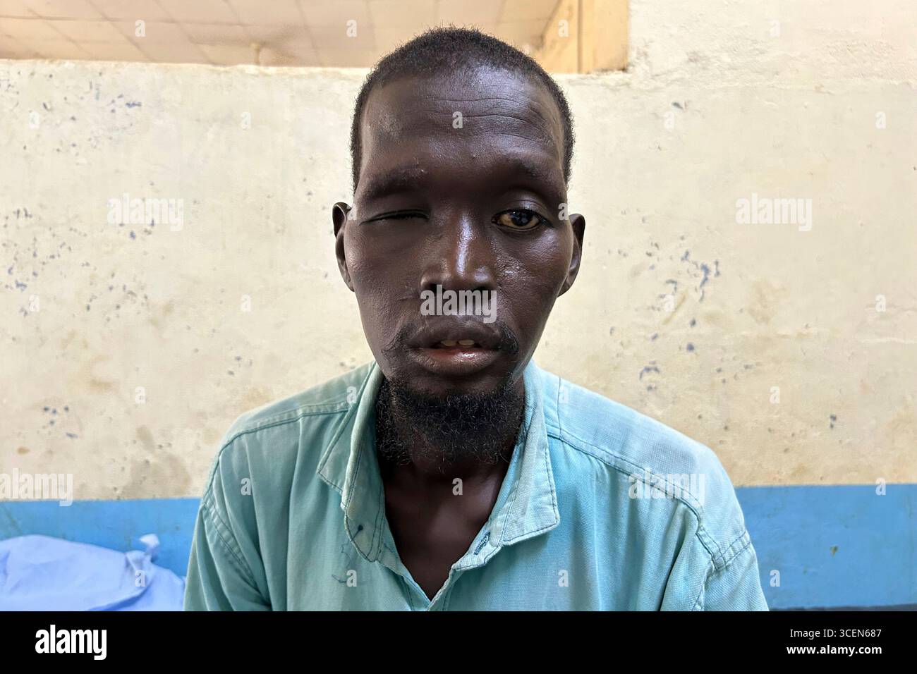 John Chan Majok Deng, 46, who claimed he lost use of his right eye after being beaten with ...
