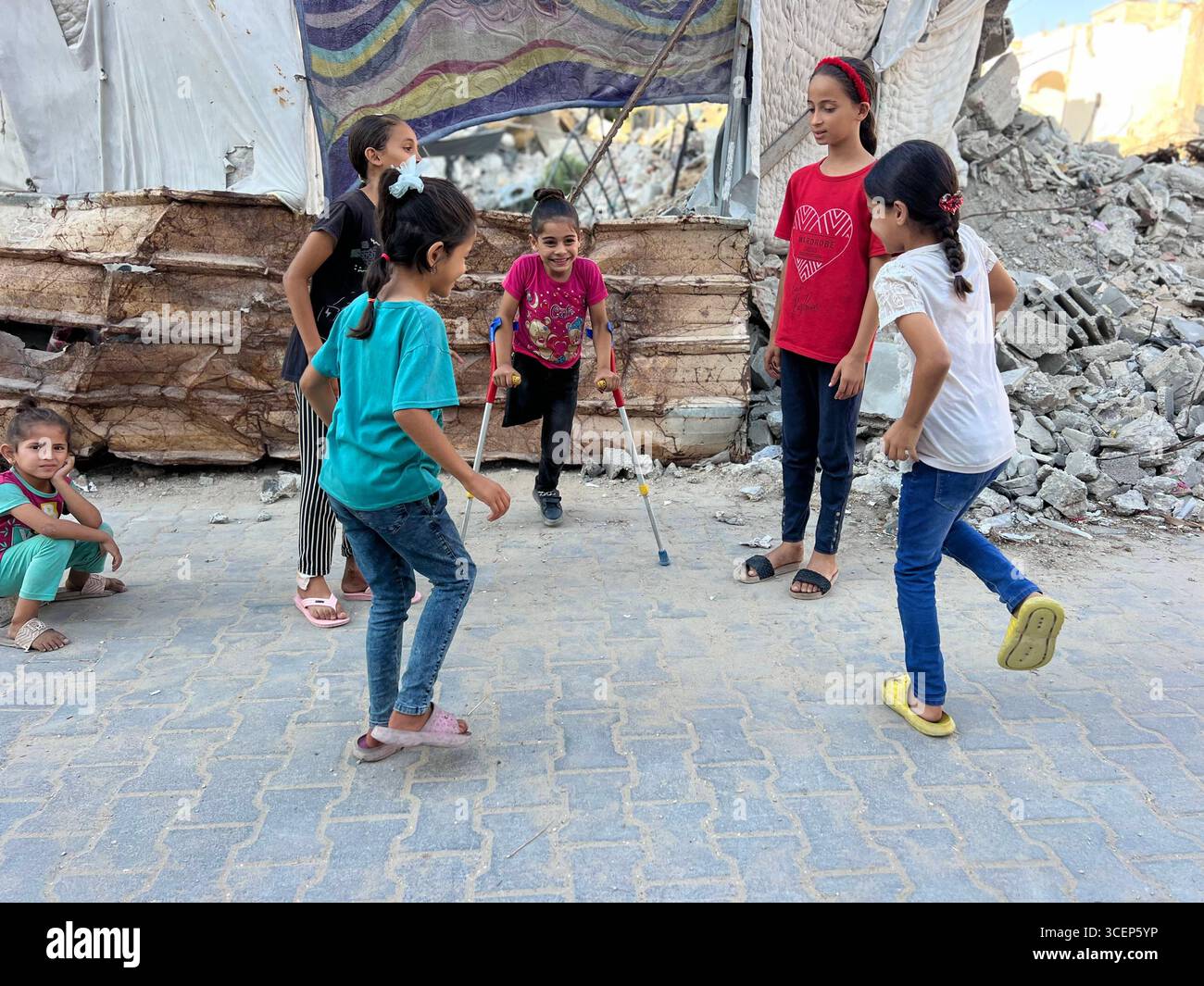 9-year-old Palestinian child Miral Al Babli is waiting for a prosthetic ...