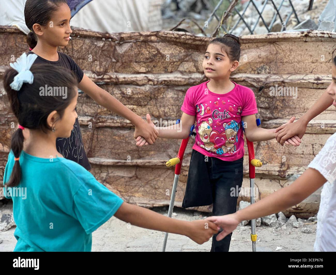 9-year-old Palestinian child Miral Al Babli is waiting for a prosthetic ...