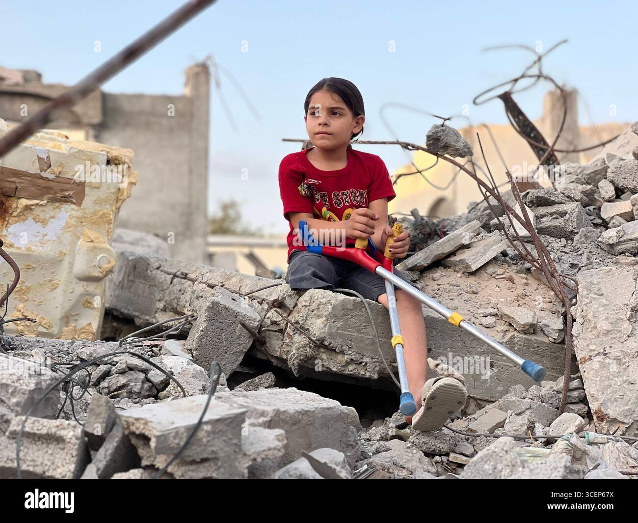 9-year-old Palestinian child Miral Al Babli is waiting for a prosthetic ...
