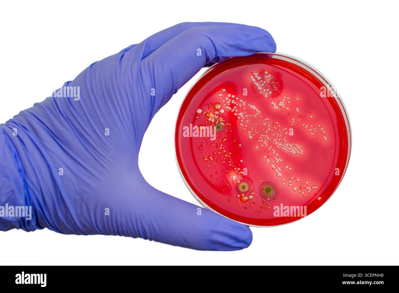 Bacterial and mold fungi colonies grown from indoor air on blood sheep ...