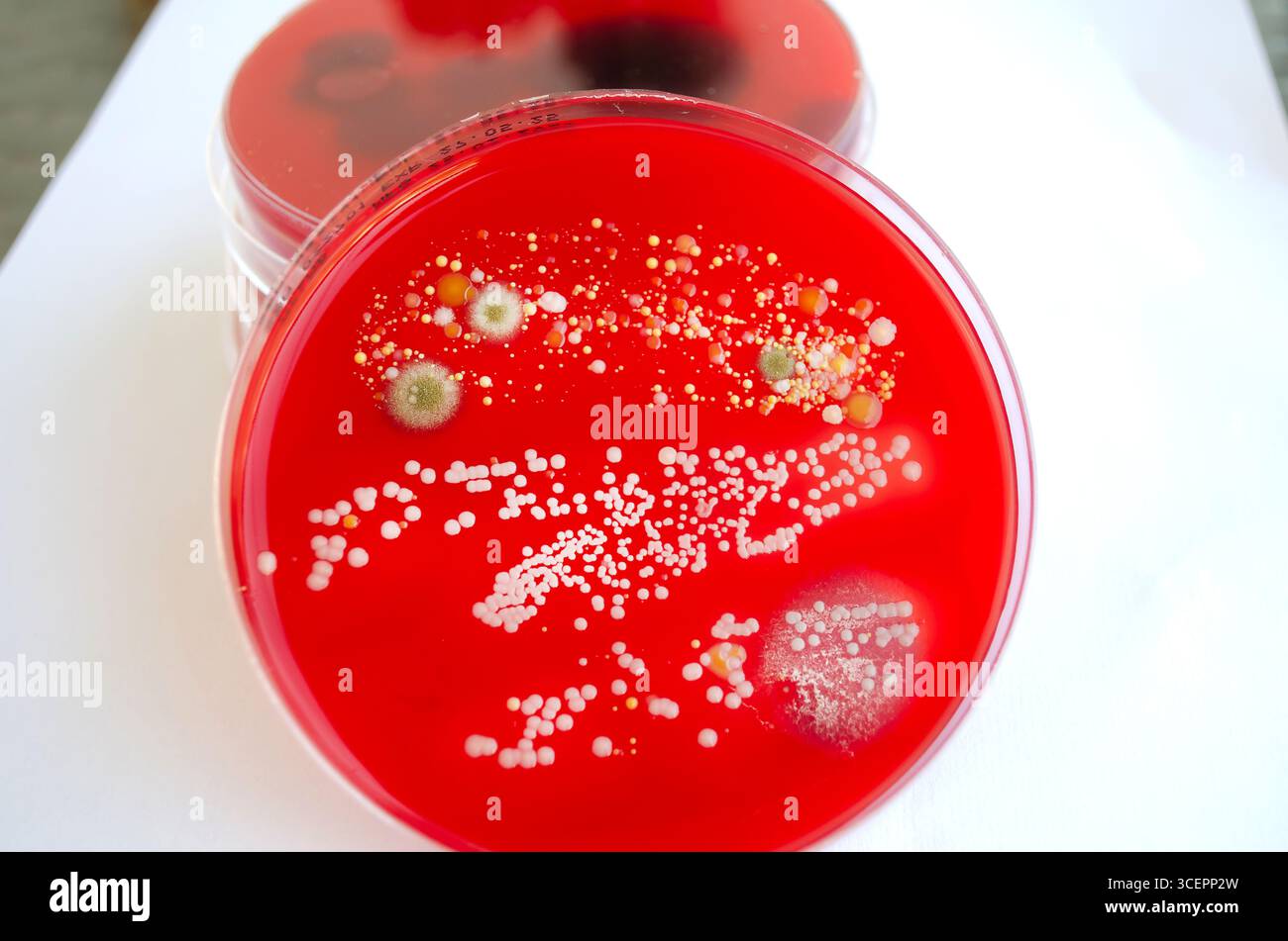 Bacterial and mold fungi colonies grown from indoor air on blood sheep ...