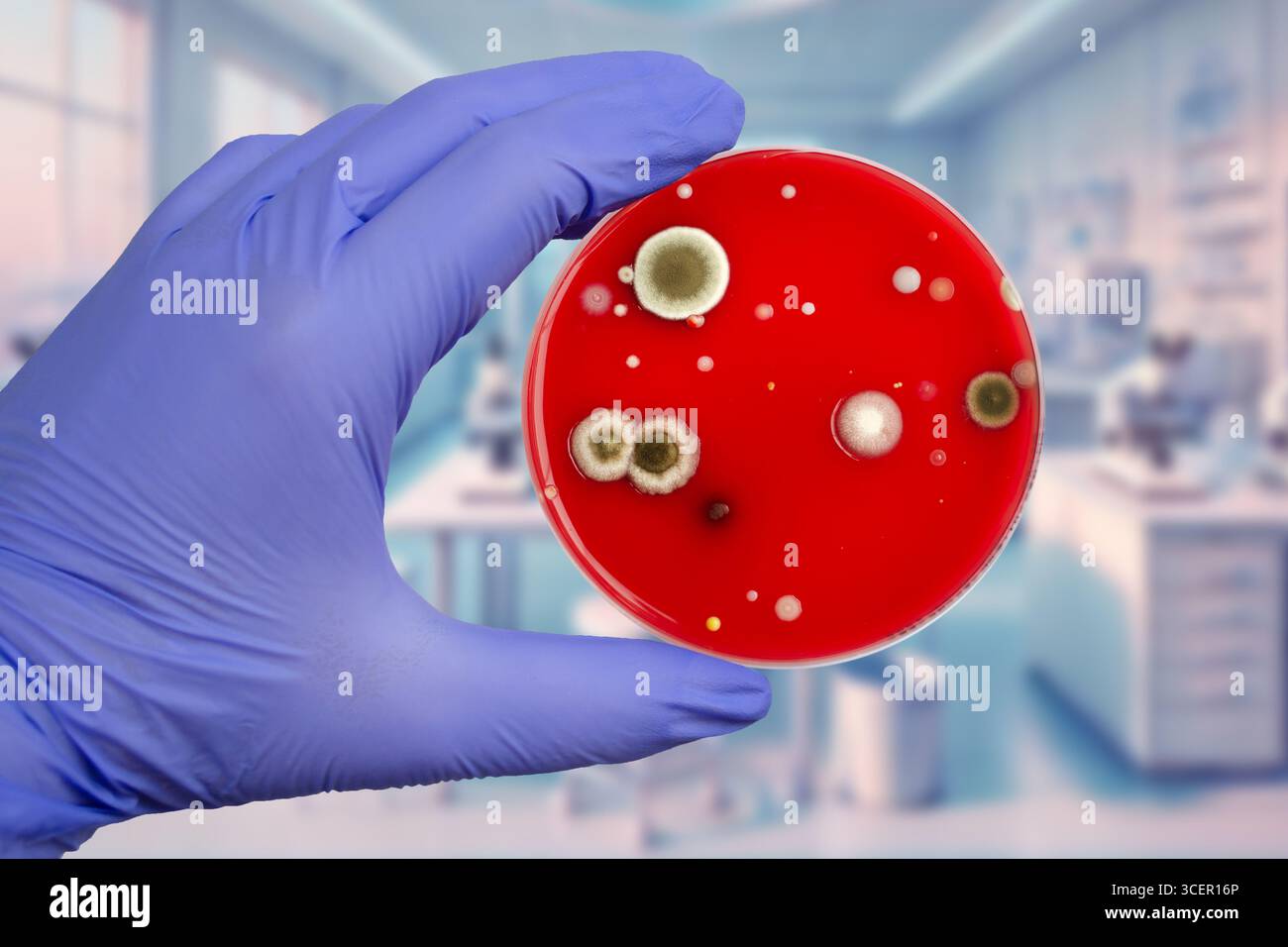 Bacterial and mold fungi colonies grown from indoor air on blood sheep ...