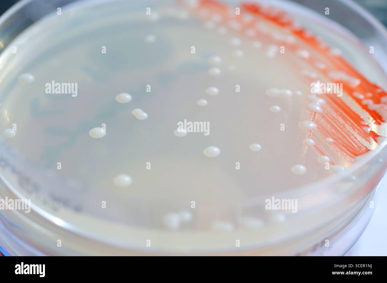 Isolated bacterial colonies on potato dextrose agar, photograph showing ...