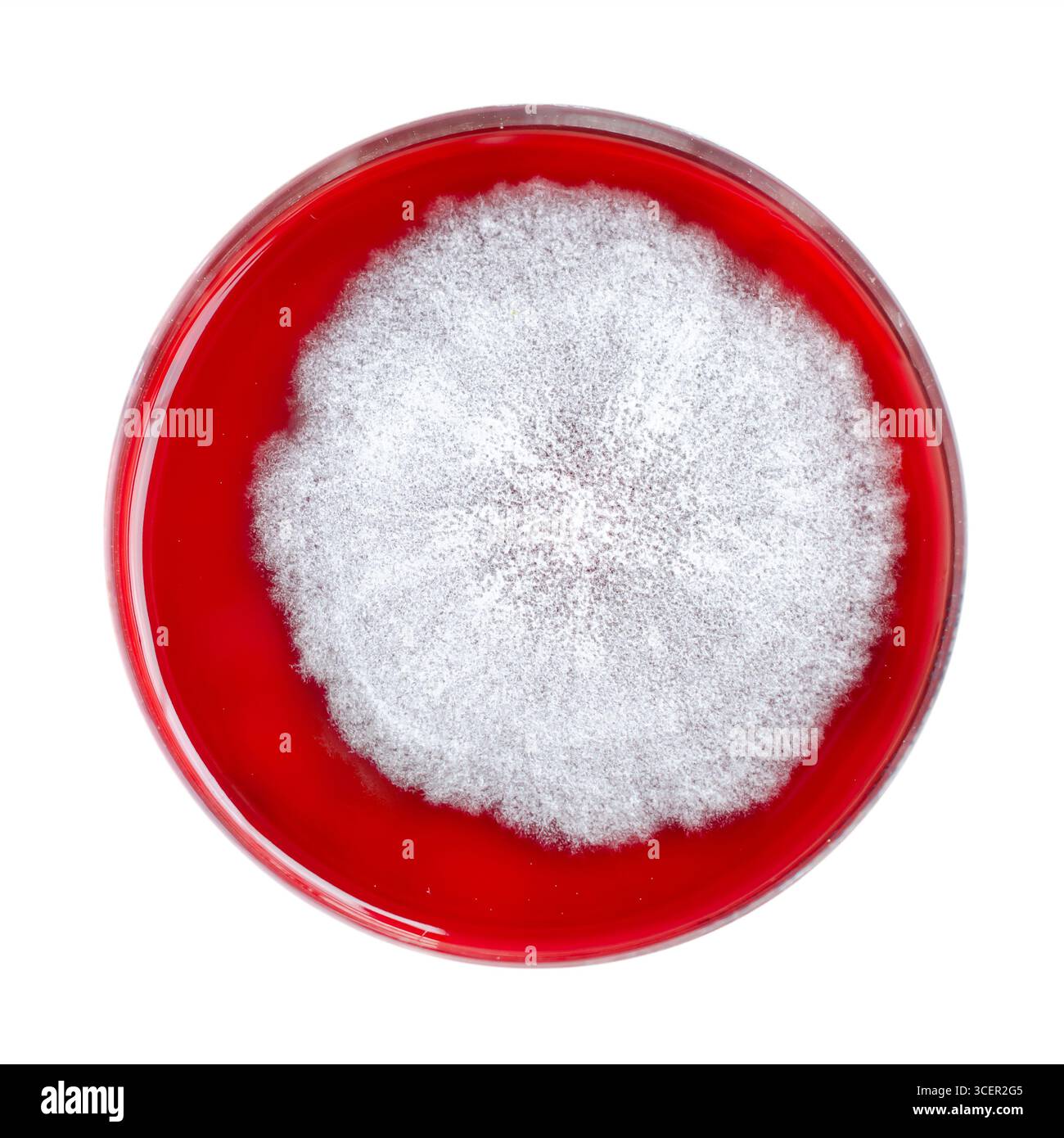 Rhinocerebral mucormycosis Cut Out Stock Images & Pictures - Alamy