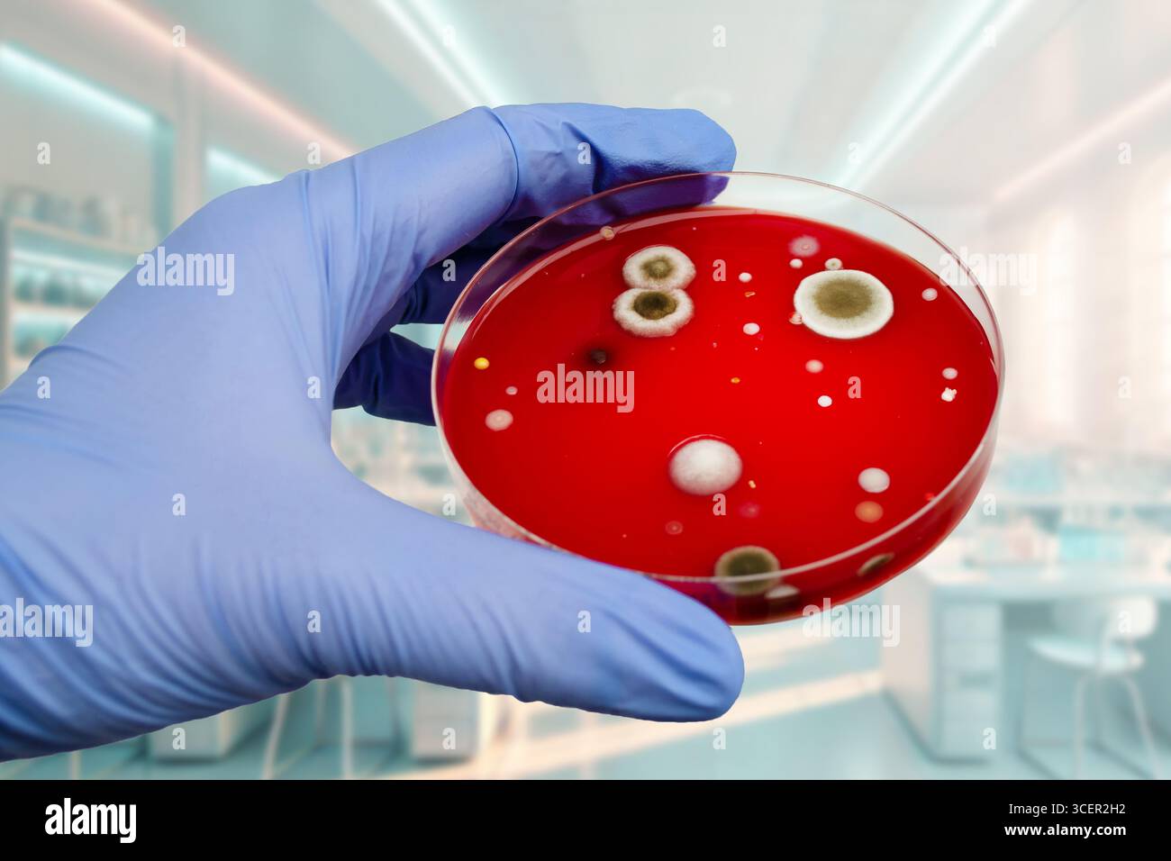 Bacterial and mold fungi colonies grown from indoor air on blood sheep ...