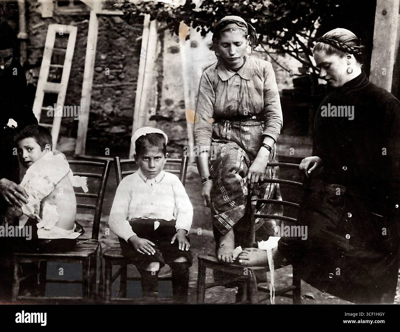 Bulgarian civilians are shown displaying their injuries from military ...