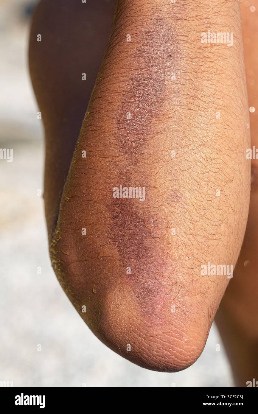 Indicating internal anatomy hi-res stock photography and images - Alamy