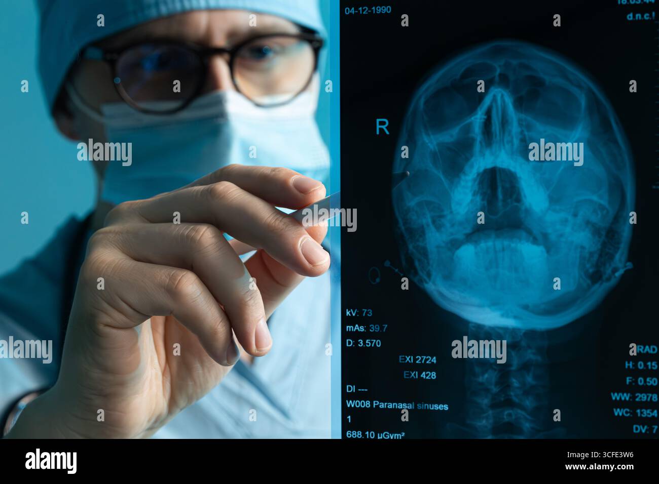Medical professional examining a skull X-ray on glass lightbox ...