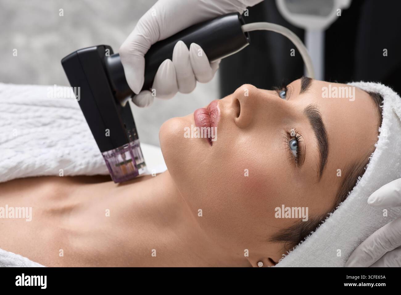 RF microneedling is cosmetic procedure for tighten and rejuvenate skin ...